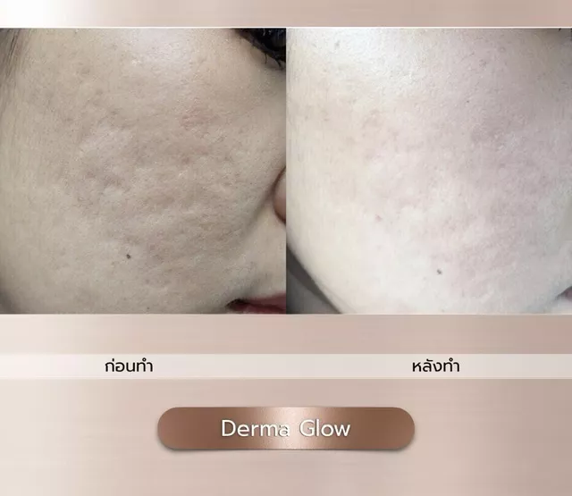 Derma Glow - Yumi Dee Skin